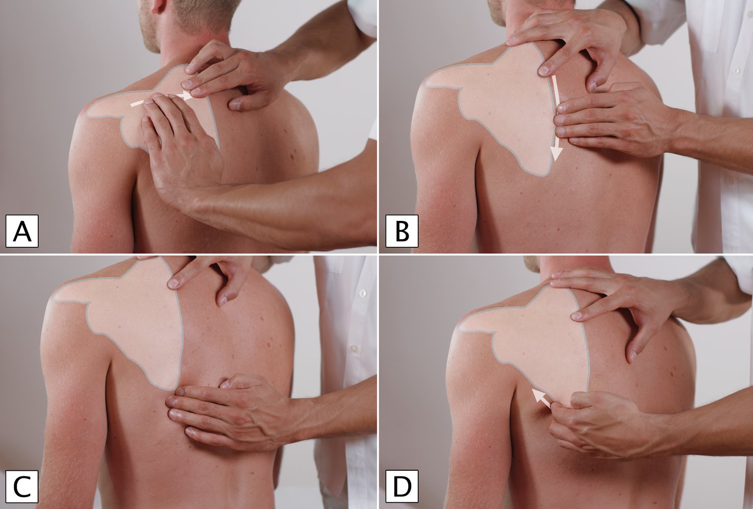 Orthopedic Shoulder Exam Orthopedic Shoulder Exam
