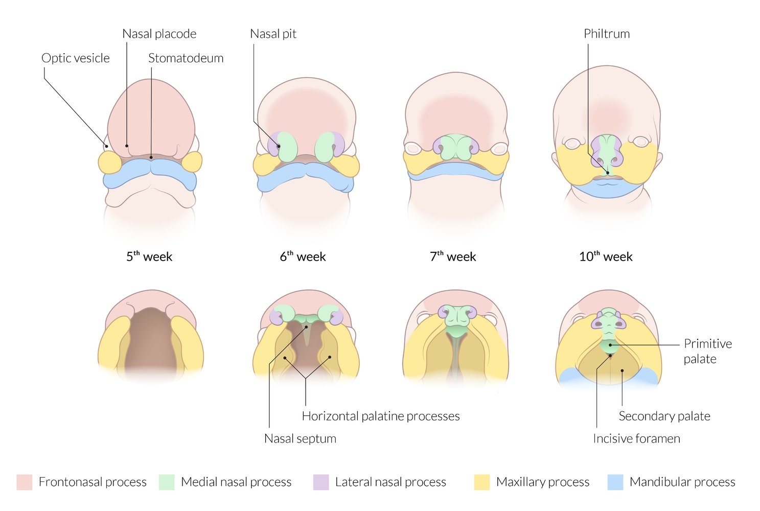 Cleft Lip Causes Embryology - Infoupdate.org