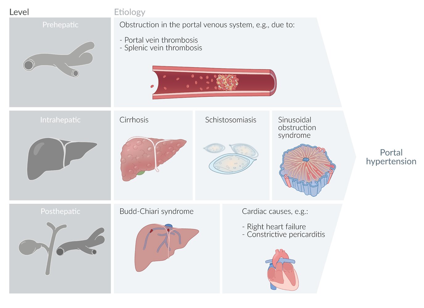 Portal Vein Thrombosis Symptoms