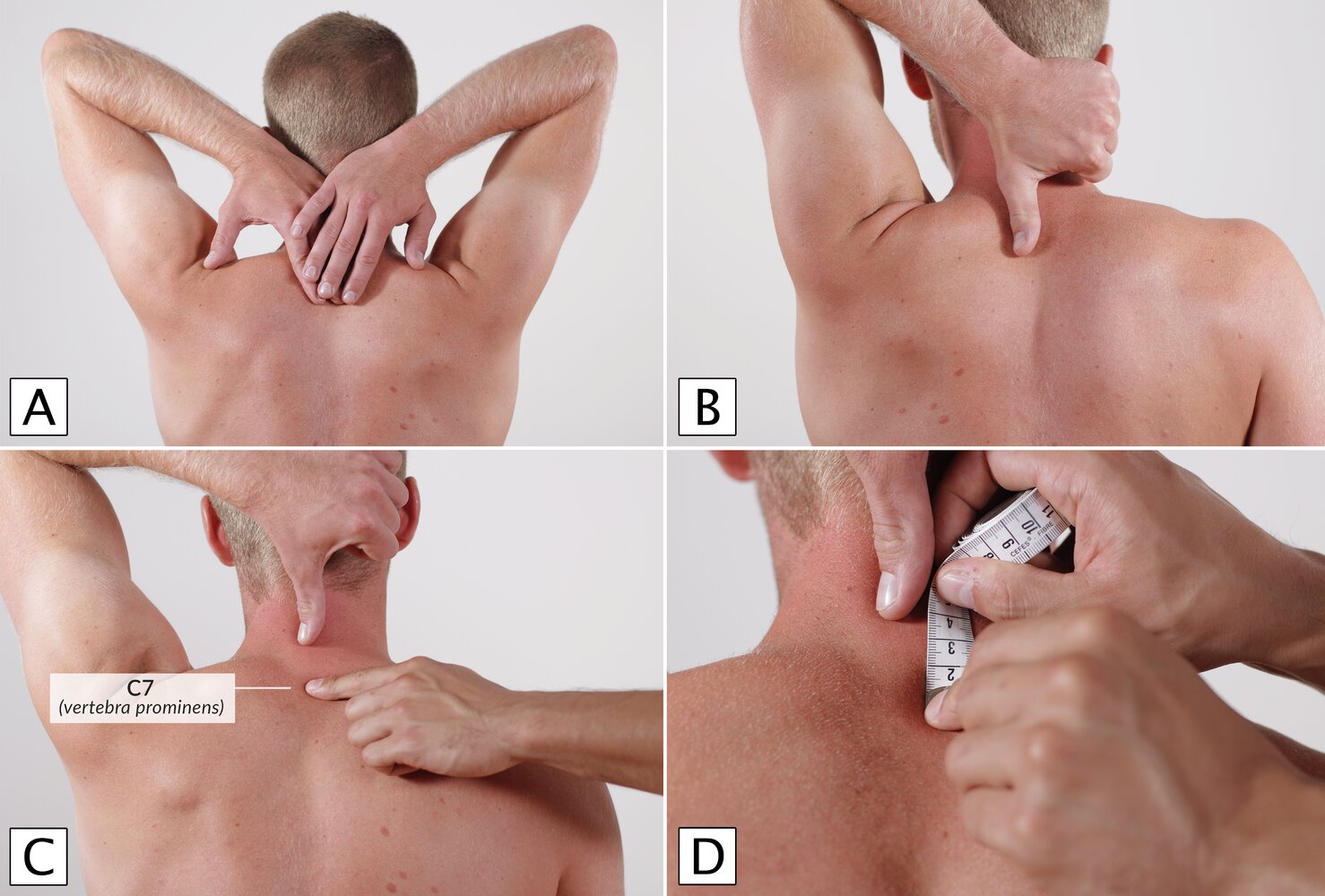 Orthopedic Shoulder Exam Orthopedic Shoulder Exam