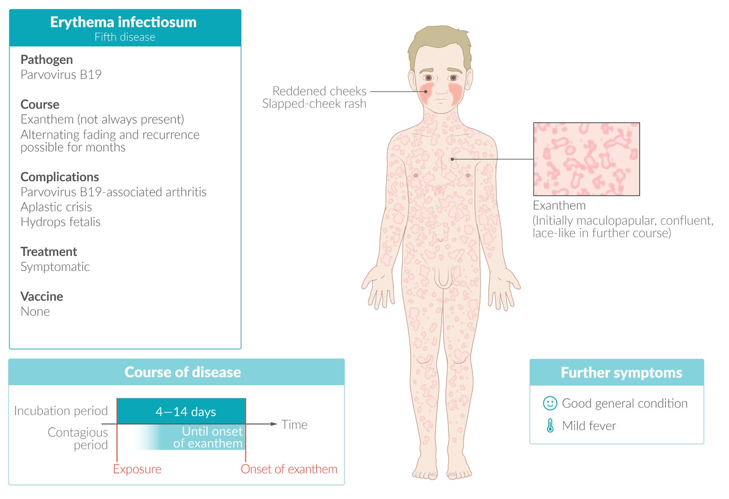 Erythema Infectiosum