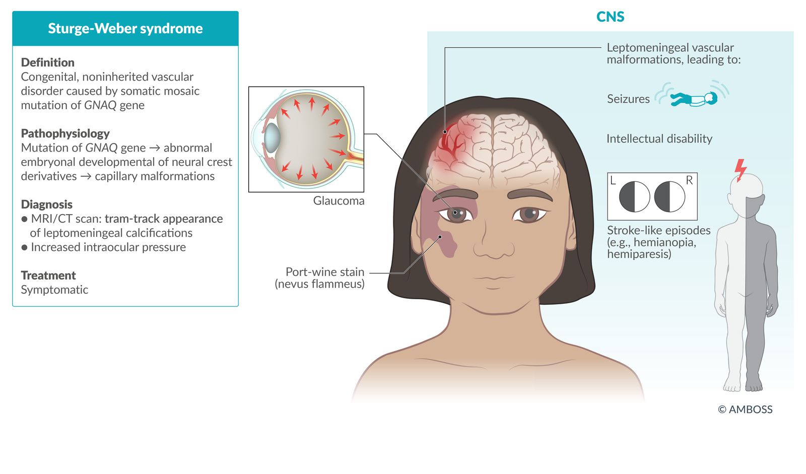 Common Neurocutaneous Syndromes Neurocutaneous Syndromes | Radiology