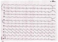 ECG - Knowledge @ AMBOSS
