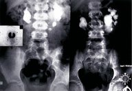 Diagnostic investigations and procedures in urology - Knowledge @ AMBOSS