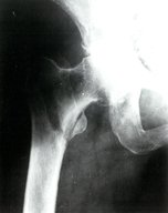 Radiography - Knowledge @ AMBOSS