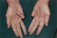 Forearm, wrist, and hand - Knowledge @ AMBOSS