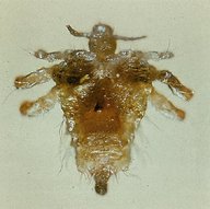 Lice infestation - Knowledge @ AMBOSS