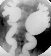 Diagnostic investigations and procedures in urology - Knowledge @ AMBOSS