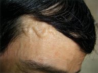 Eye pain and red eye - Knowledge @ AMBOSS