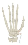 Clinical features