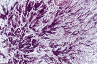 General mycology - Knowledge @ AMBOSS