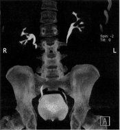 Diagnostic investigations and procedures in urology - Knowledge @ AMBOSS
