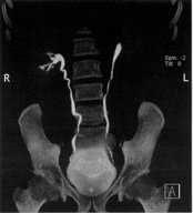 Diagnostic investigations and procedures in urology - Knowledge @ AMBOSS