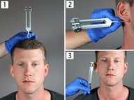 Head and neck examination - Knowledge @ AMBOSS