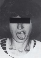 Oral cavity - Knowledge @ AMBOSS