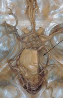 Cerebrovascular system - Knowledge @ AMBOSS