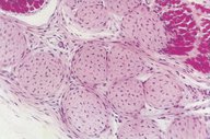 Muscle tissue - Knowledge @ AMBOSS