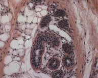 Skin and skin appendage - Knowledge @ AMBOSS