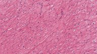 Pericardium