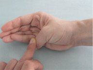 Orthopedic examination - Knowledge @ AMBOSS