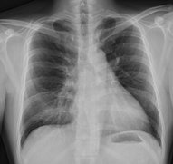 Chest wall - Knowledge @ AMBOSS