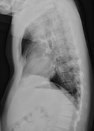 Chest wall - Knowledge @ AMBOSS