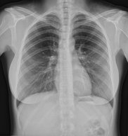 Soft tissue lesions of the shoulder - Knowledge @ AMBOSS