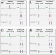 Cardiovascular examination - Knowledge @ AMBOSS