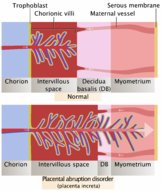 Postpartum hemorrhage - Knowledge @ AMBOSS