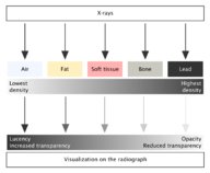Radiography - Knowledge @ AMBOSS