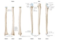 Radius (bone)