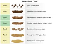 Constipation - Knowledge @ AMBOSS