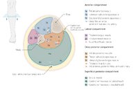 Acute compartment syndrome - Knowledge @ AMBOSS