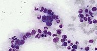 Anemia - Knowledge @ AMBOSS