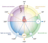 ECG - Knowledge @ AMBOSS