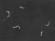 Congenital TORCH infections - Knowledge @ AMBOSS