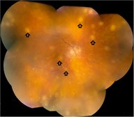 Traumatic eye injuries - Knowledge @ AMBOSS