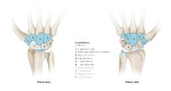 Carpal ligament injuries - Knowledge @ AMBOSS