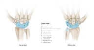 Carpal ligament injuries - Knowledge @ AMBOSS