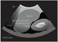ABCDE approach - Knowledge @ AMBOSS