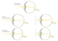 Eye and orbit - Knowledge @ AMBOSS