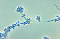 Overview of fungal infections - Knowledge @ AMBOSS