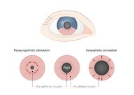 Physiology and abnormalities of the pupil - Knowledge @ AMBOSS