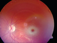 Examination of the eye - Knowledge @ AMBOSS