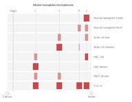 Sickle cell disease - Knowledge @ AMBOSS