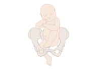 Abnormal labor and delivery - Knowledge @ AMBOSS