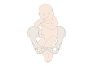 Abnormal labor and delivery - Knowledge @ AMBOSS