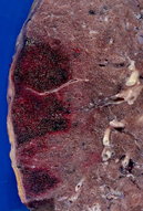 Cellular changes and adaptive responses - Knowledge @ AMBOSS