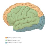 Overview of stroke - Knowledge @ AMBOSS