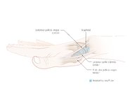Scaphoid fracture - Knowledge @ AMBOSS